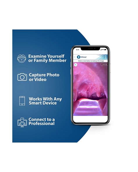 Throat Scope Telscope Telehealth System — Mckin Health
