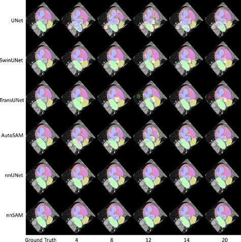 NnSAM Plug And Play Segment Anything Model Improves NnUNet Performance