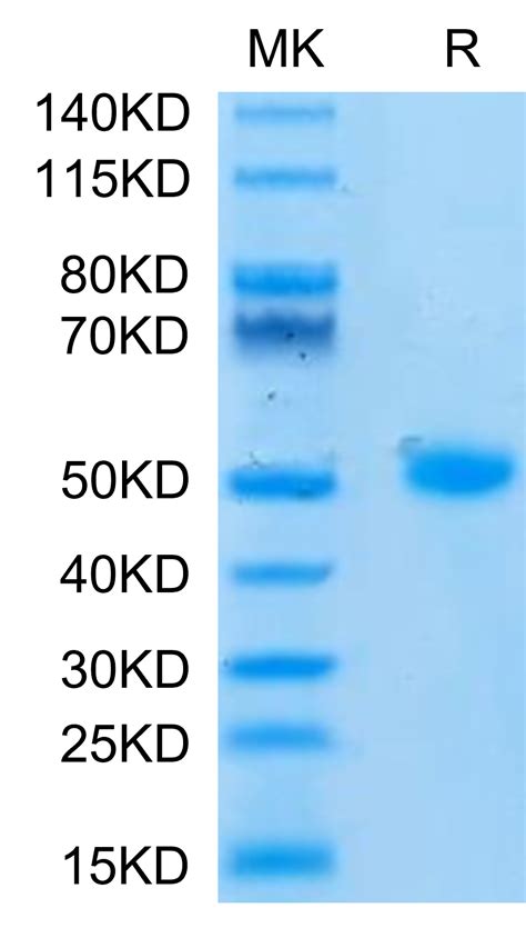 Human Cd137 Dc Sign Protein Recombinant Reprokine