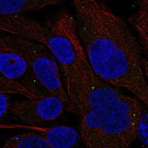 Rabbit Polyclonal Anti Gsdmc Antibody Buy For Research Highly