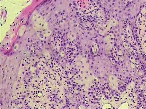 病例详情 病例 人卫临床助手 人民卫生出版社