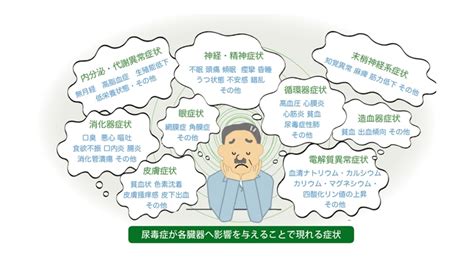 尿毒症の症状をきちんと理解して体調を把握する Npo法人 腎臓サポート協会