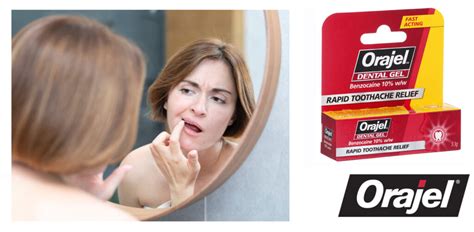Why Recommend Orajel® The Probe
