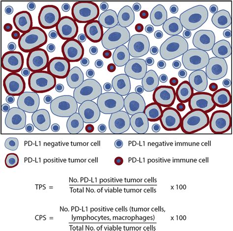 Calculation Of Tps And Cps Schematic Image Of Tumor Specimen Stained Download Scientific