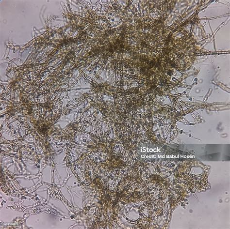 Foto De Fungos Microscópicos Malassezia Furfur Mostrando Células De