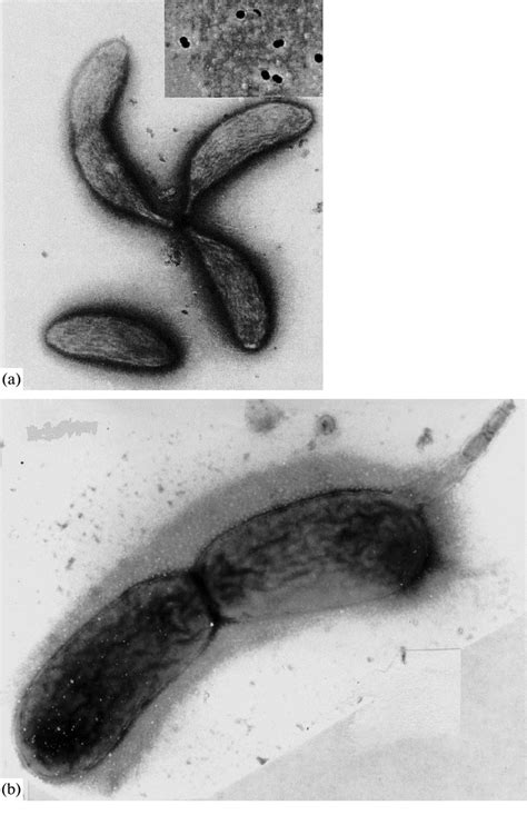 Electron Microscopic Photographs Of Dissipotrophic Bacteria A
