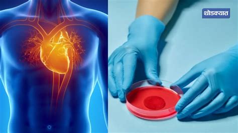 Heart Disease Healing Patch हिलिंग पॅच ठरणार हृदयरोग्यांसाठी वरदान