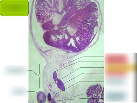 Level Of Common Bile Duct 3 Of 3 Diagram Quizlet