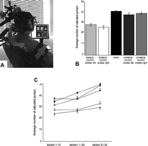 A TMS Equipment Coupled With A Navigation System To Localize The Download Scientific Diagram