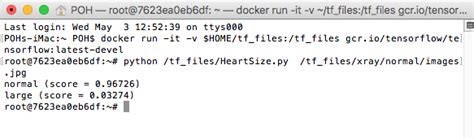 Machine Learning Tensorflow Deep Learning Tutorial The Heart Size