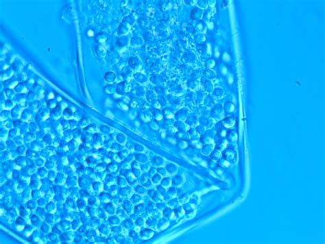 Dorylaimida Applied Nematology Ecology And Acoustical Signatures