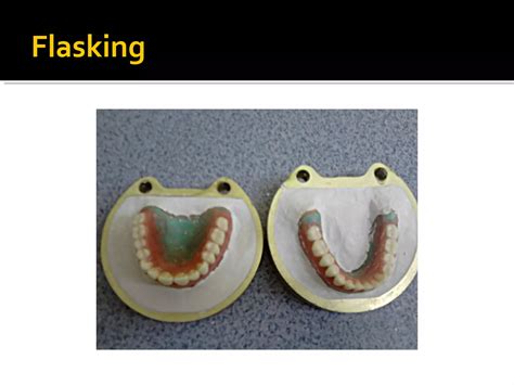 Complete Denture Prosthodontics Step By Step Ppt