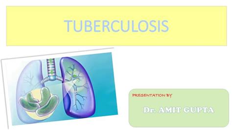 Tuberculosis Case Presentation Tb Pptx Pptx