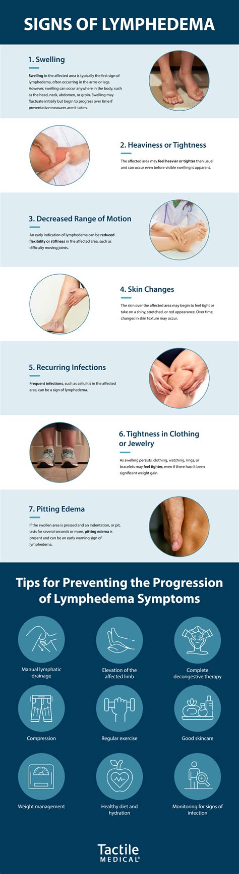 Lymphedema Description