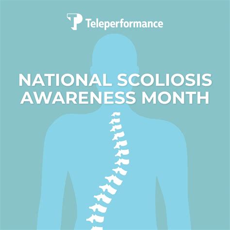 Teleperformance Philippines Scoliosis Is A Sideways Curvature Of The