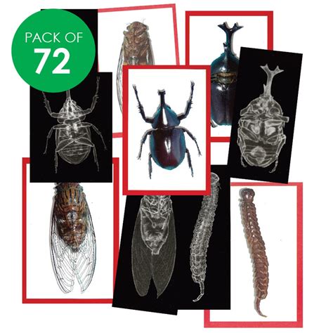 Insect X Rays And Picture Cards Pack Of 72 Light Box And X Rays