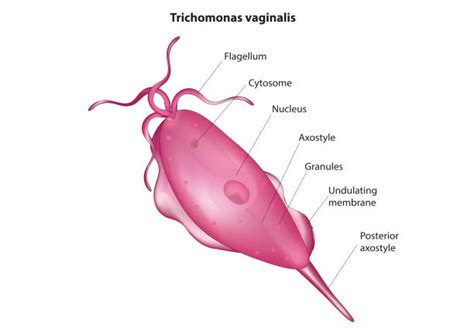 30 Trichomoniasis Stock Illustrations Royalty Free Vector Graphics