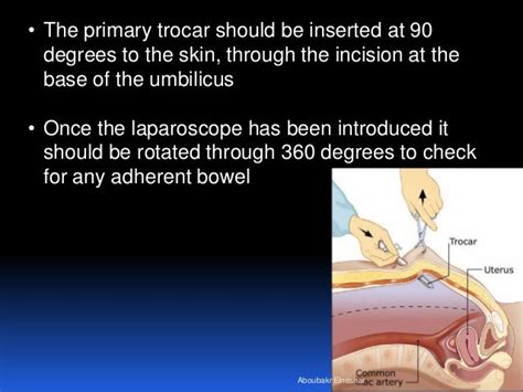 LAPAROSCOPIC ENTRY