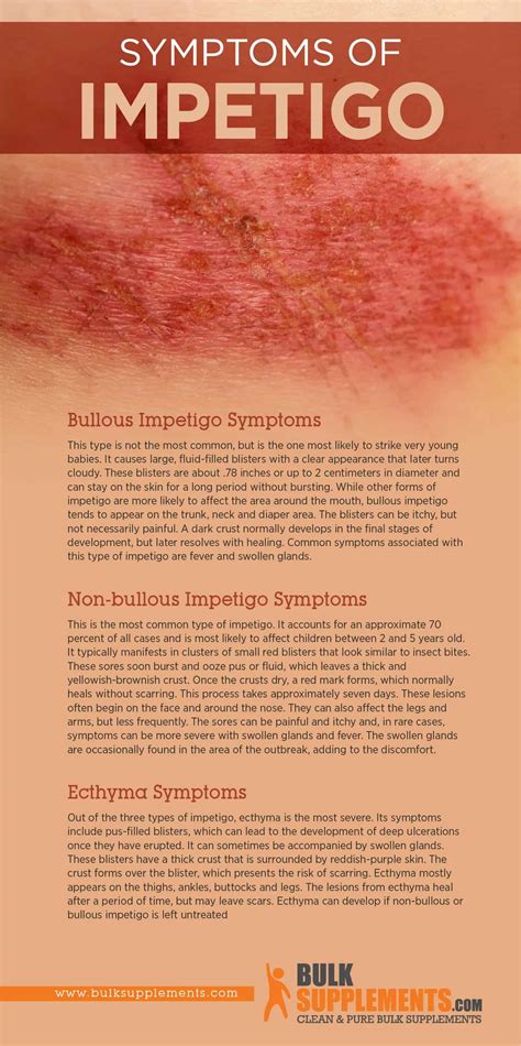How To Diagnose Impetigo Amountaffect17