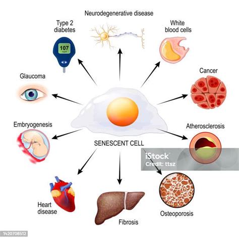 Zelluläre Seneszenz Und Gesundheitsrisiken Rollen Die Seneszente Zellen