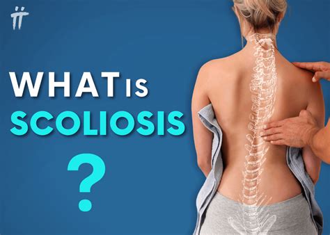 Scoliosis Symptoms ﻿diers 4dmotion® Diers International Gmbh