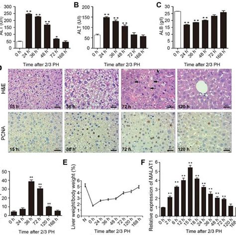 Metastasis Associated Lung Adenocarcinoma Transcript 1 Malat1 Download Scientific Diagram