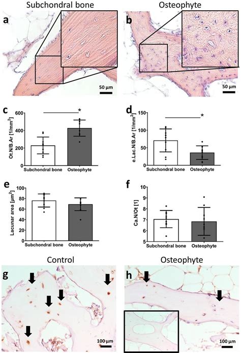 Osteocyte Network Characteristics Within Osteophytes Ab