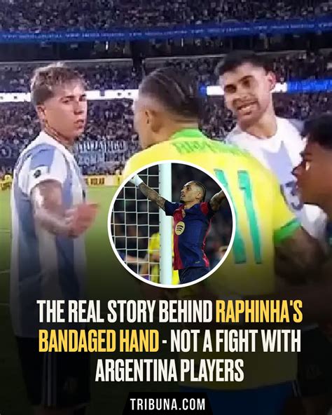 Barcelona So Its All About Another Reason 😮 Explained Why Raphinha Wears A Bandage On His