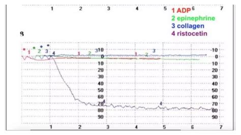 Platelet Function Tests Pptx Platelet Function Tests Pptx