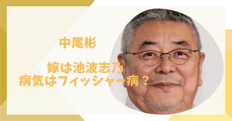 中尾彬の妻嫁志乃の病気はフィッシャー症候群！子供はいないし終活中？死因なぜ？ Entertainment No Tukuriba