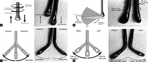 A Advance Withdraw Pushing Or Pulling The Tip Of The Tee Probe B