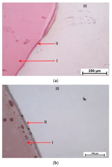 Comparative Study On Interface Fracture Of 4th Generation 3 Steps