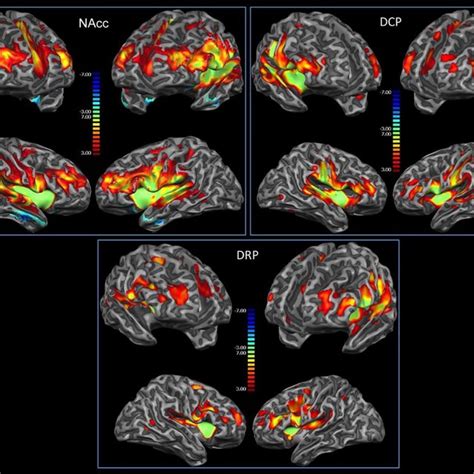 Resting State Functional Connectivity Of The Nucleus Accumbens Nacc Download Scientific