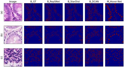 Repsnet A Nucleus Instance Segmentation Model Based On Boundary Regression And Structural Re