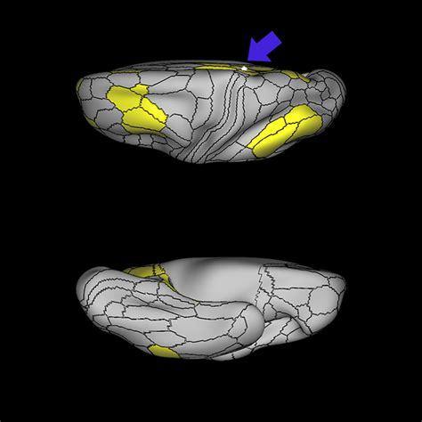 Default Mode Network Connectome Guide