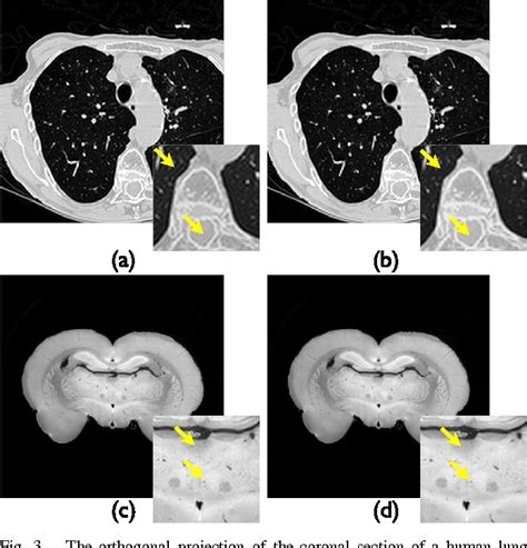 Figure 3 From Optimized Kaiser Bessel Window Functions For Computed Tomography Semantic Scholar
