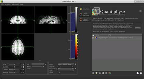 Qbold Tutorial — Quantiphyse Documentation