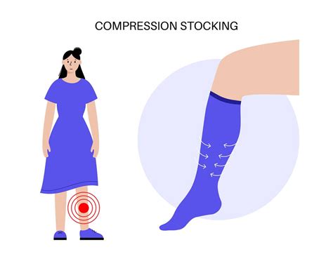 Medicare Coverage For Compression Socks
