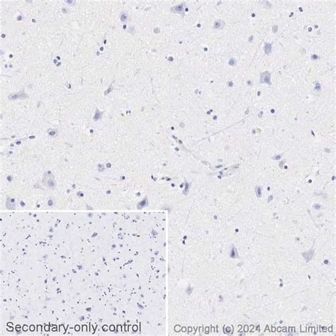 Avidinbiotin Blocking Kit 15 Ml Ab64212 Abcam