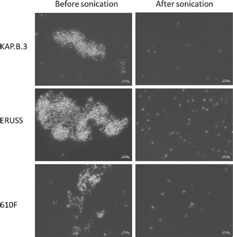 Visual Representation Of Spore Clumping In C Botulinum Group Ii
