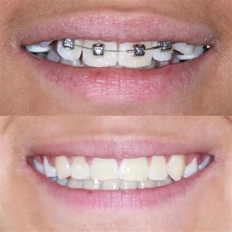 Smile Gallery Beyond Infinity Dental