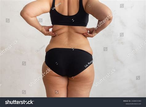 Fat Under Buttocks Photos Images And Pictures Shutterstock