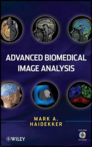 Advanced Biomedical Image Analysis St Edition EMEDICAL BOOKS