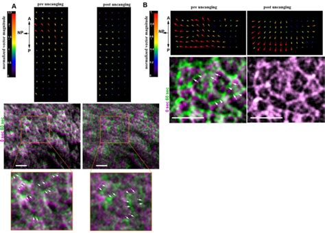 Fig S11 Increased Surface Ectoderm Contractility Negatively Impacts