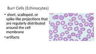 Erythrocyte Morphology And Inclusions 2 2 Pptx
