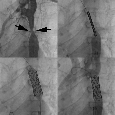 Pediatric Cardiac Catheterization Program Patient Care