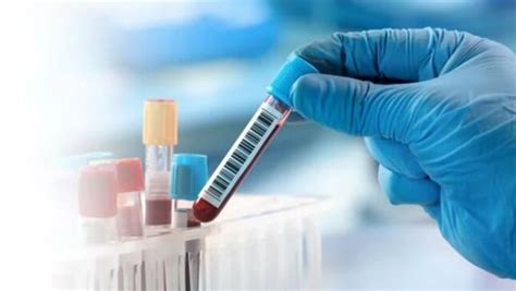 Clinitech Laboratory Ipo To Open For Subscription Tomorrow Check Price