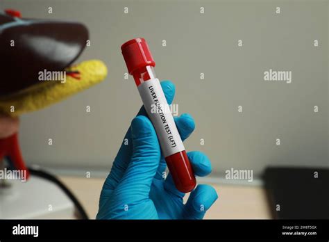 Laboratory Worker Holding Tube With Blood Sample And Label Liver