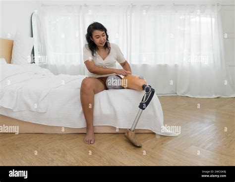 Bein Amputierte Frau Fotos Und Bildmaterial In Hoher Auflösung Alamy