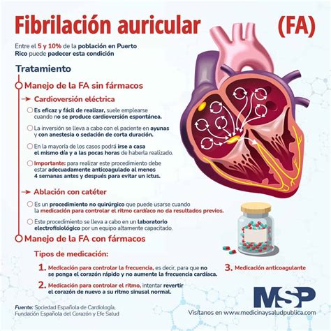 Fibrilación Auricular Infografía